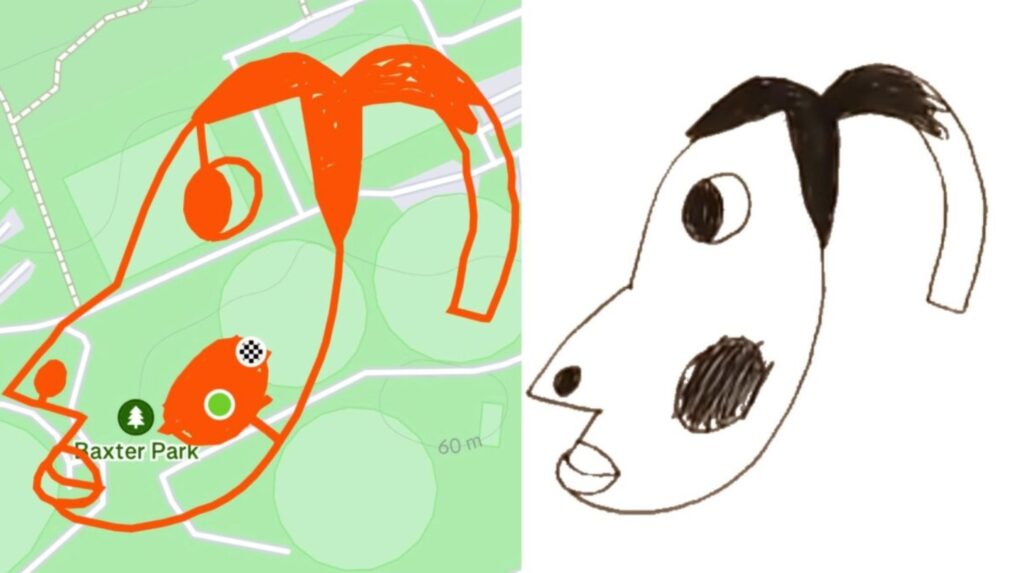 10 Powerful Reasons Why Hyperpigmentation Memes Are So Relatable for ...